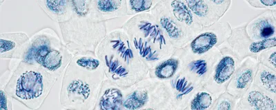 How the Nucleus Made its Great Debut | The Scientist