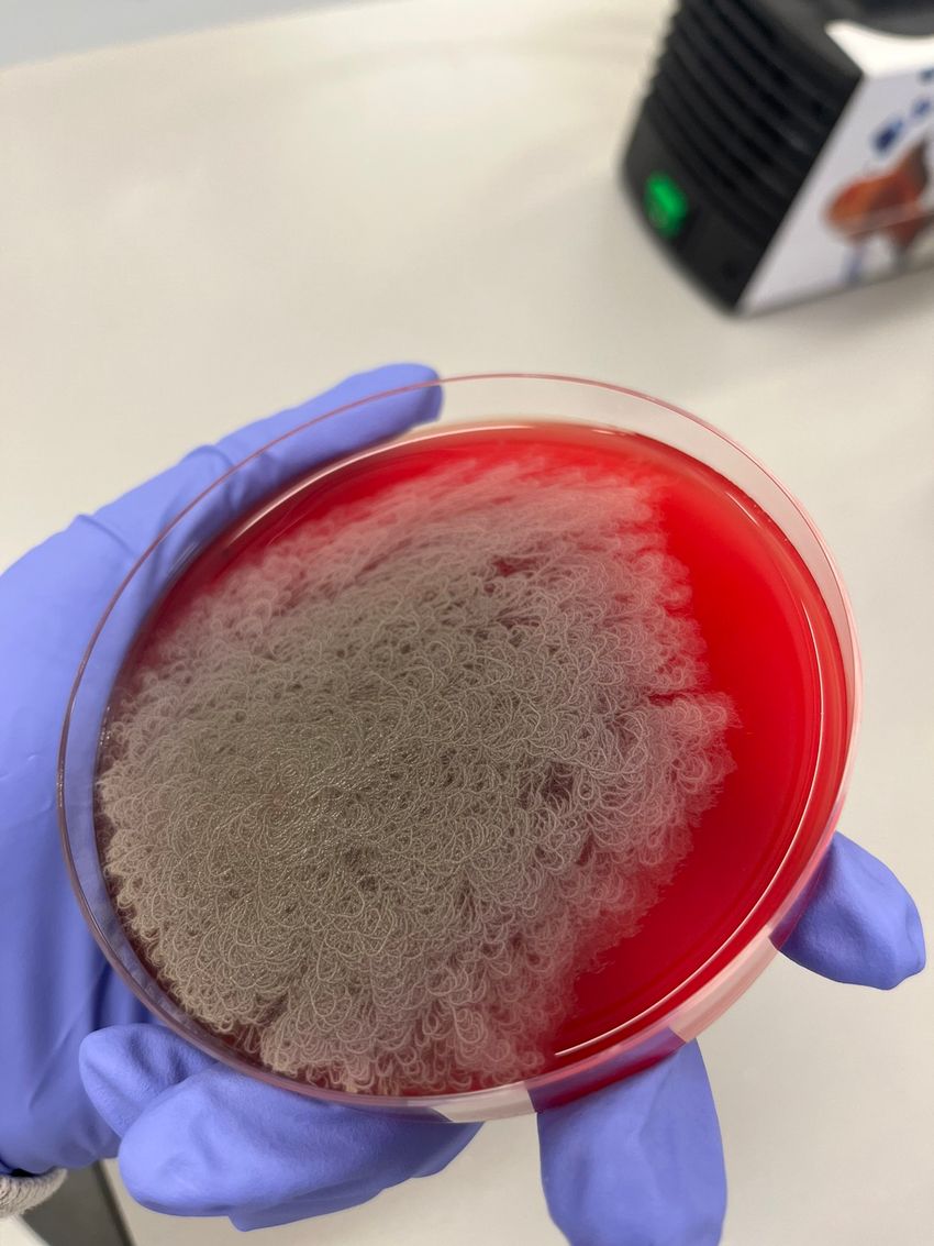 Contamination and the Curious Case of Noodlococcus | The Scientist