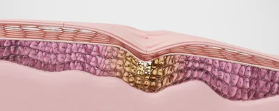 Rapid Senescence Onset in Skin Cells Aids Wound Healing | The Scientist