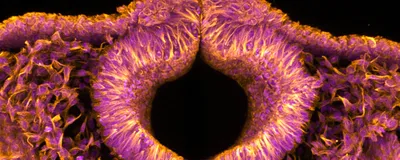 Quail Embryos Illuminate Human Birth Defects Via Microscopy Analyses ...
