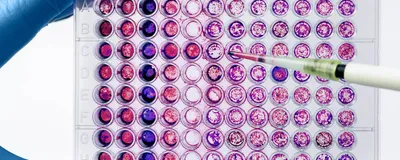 Addressing Antibody Developability Challenges Earlier | The Scientist