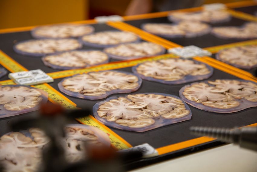 The Brain Health Accelerator Seeks to Revolutionize Neuroscience ...