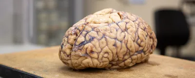 The Brain Health Accelerator Seeks to Revolutionize Neuroscience ...
