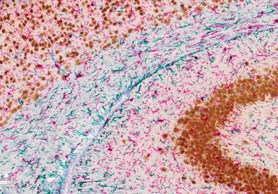 Advancing Pathology Workflows with AI-Driven Quality Control | The ...