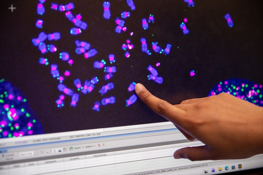 Centromeres Leave Footprints on Telomeres in Aggressive Cancers | The ...