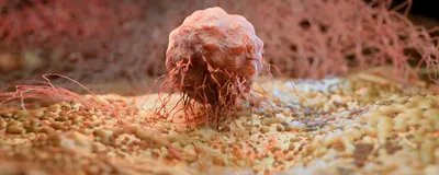 Vitamin D-Like Drug Plus Chemotherapy Proves Safe in Pancreatic Cancer ...