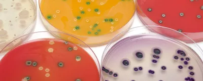 Scientists Pick Their Favorite Microorganisms | The Scientist