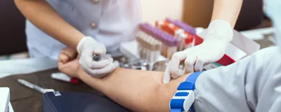 Blood NAD+ Levels Are Poor Biomarkers for Biological Aging | The Scientist