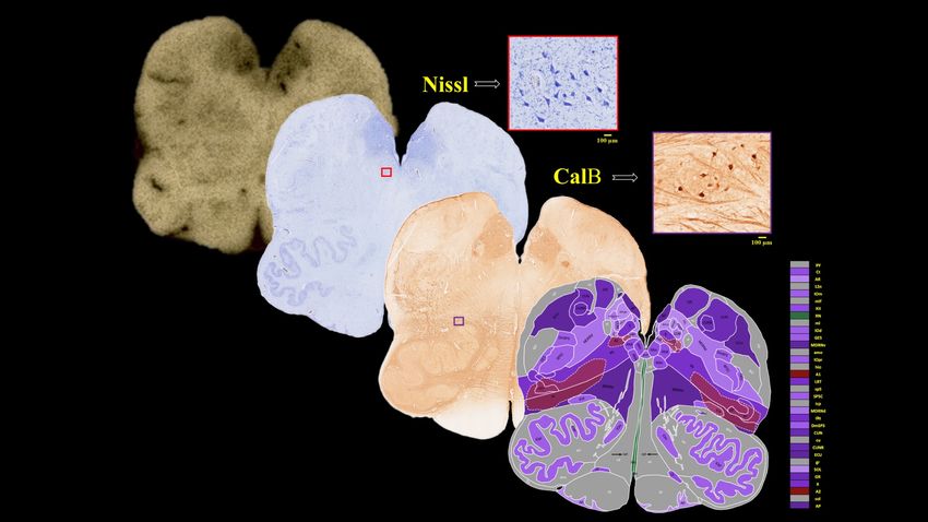 ANCHOR Brainstem Atlas Reveals Hidden Anatomy of the Human Brain | The ...