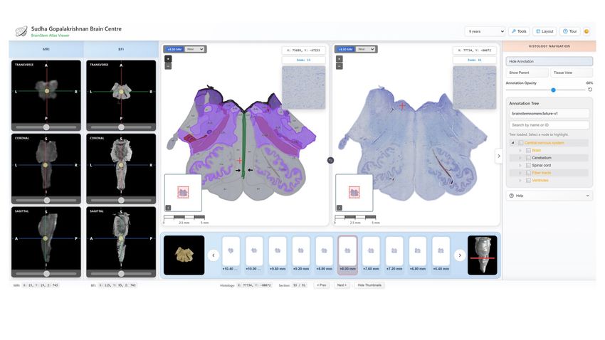 ANCHOR Brainstem Atlas Reveals Hidden Anatomy of the Human Brain | The ...
