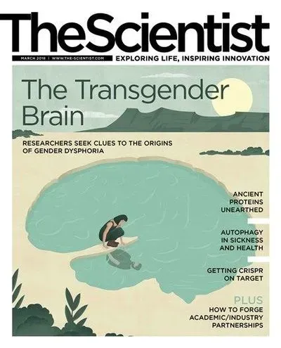 Are the Brains of Transgender People Different from Those of Cisgender ...